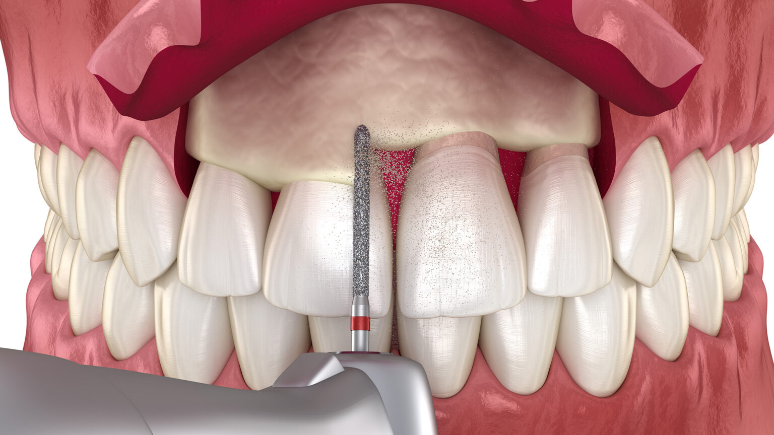 65 Broadway Dental | NYC’s Trusted Dental Implant Experts