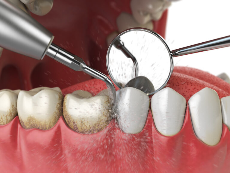 65 Broadway Dental | NYC’s Trusted Dental Implant Experts
